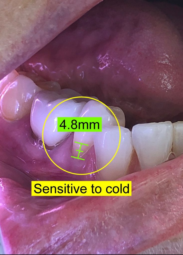 Socially Distanced Dentistry - Oral Health Group
