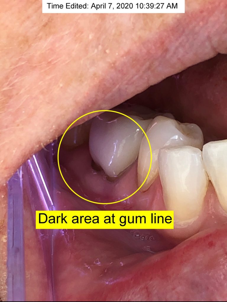 Socially Distanced Dentistry - Oral Health Group