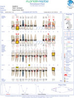 Effective Periodontal Charting Leads to Effective Periodontal Care