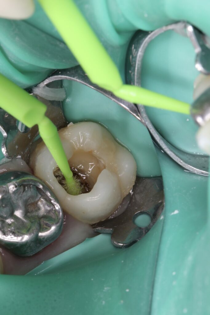 Smart Dentistry for the Kids in Your Practice - Silver Modified ...