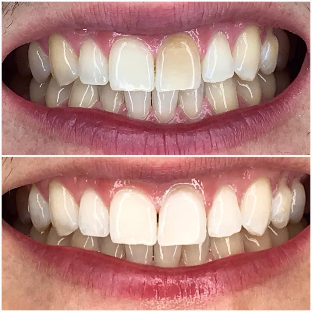 Minimally Invasive Cosmetic Dentistry: Simple Techniques to Improve ...