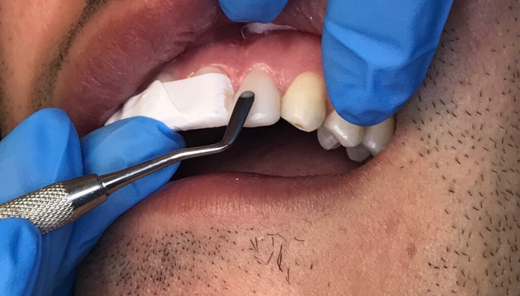 Minimally Invasive Cosmetic Dentistry: Simple Techniques to Improve ...