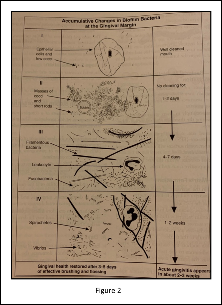 Plaque Analysis: The Oral Health You Can See - Oral Health Group