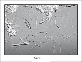 Plaque Analysis: The Oral Health You Can See - Oral Health Group