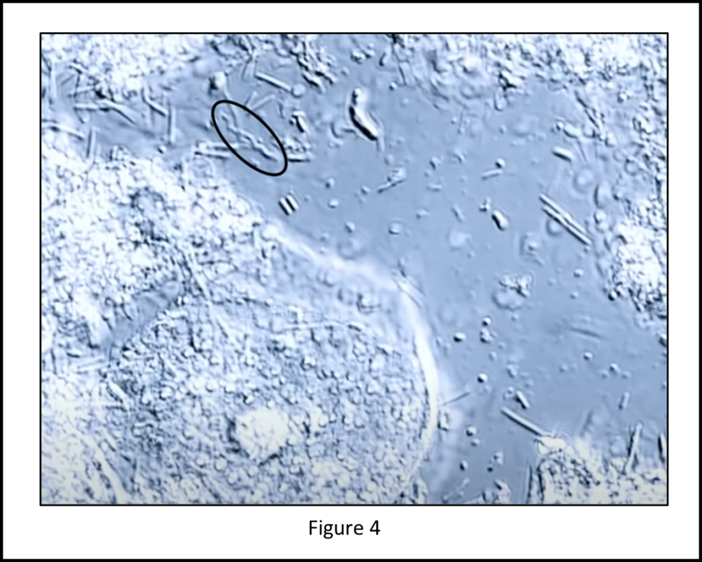 Plaque Analysis: The Oral Health You Can See - Oral Health Group
