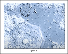 Plaque Analysis: The Oral Health You Can See - Oral Health Group