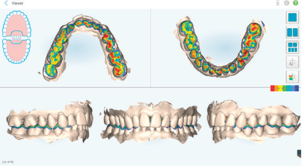 Growing Your Practice with the Invisalign® Brand - Oral Health Group