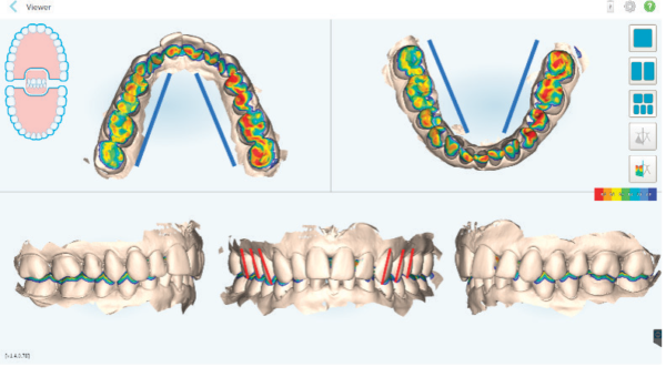 Growing Your Practice with the Invisalign® Brand - Oral Health Group