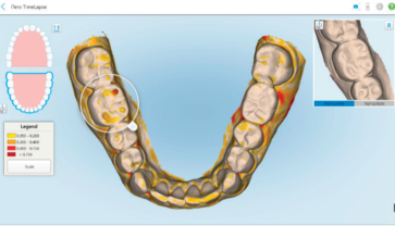 Growing Your Practice with the Invisalign® Brand - Oral Health Group
