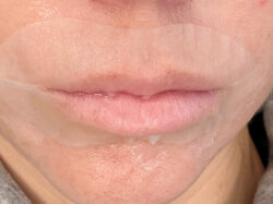 Lips: The Forgotten Oral Tissue - Oral Health Group