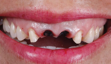 Minimally Invasive, Inter-Disciplinary Management for Cosmetic ...