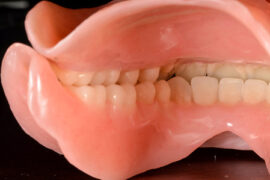 Lingualized Occlusion: An Occlusal Scheme for Complete Dentures in ...