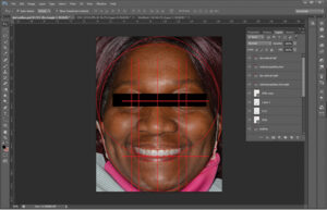 Kumar Fig 6 Smile design in photoshop - Oral Health Group