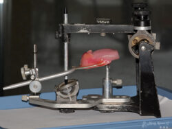 Kumar Fig 8 Facebow transfer - Oral Health Group