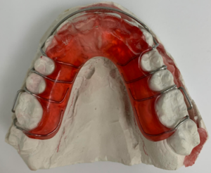 A Review of Intraoral Appliances for Temporomandibular Disorders ...