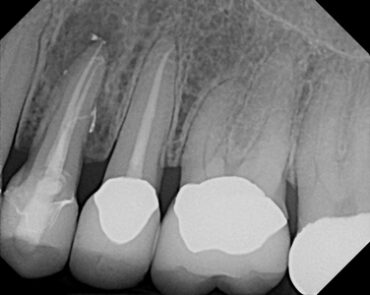 Endodontics Through the Looking Glass - Oral Health Group