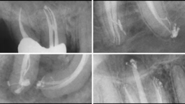 The Ultimate Shaping System: An Opening for 3D Cleaning and Filling ...