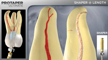 The Ultimate Shaping System: An Opening for 3D Cleaning and Filling ...