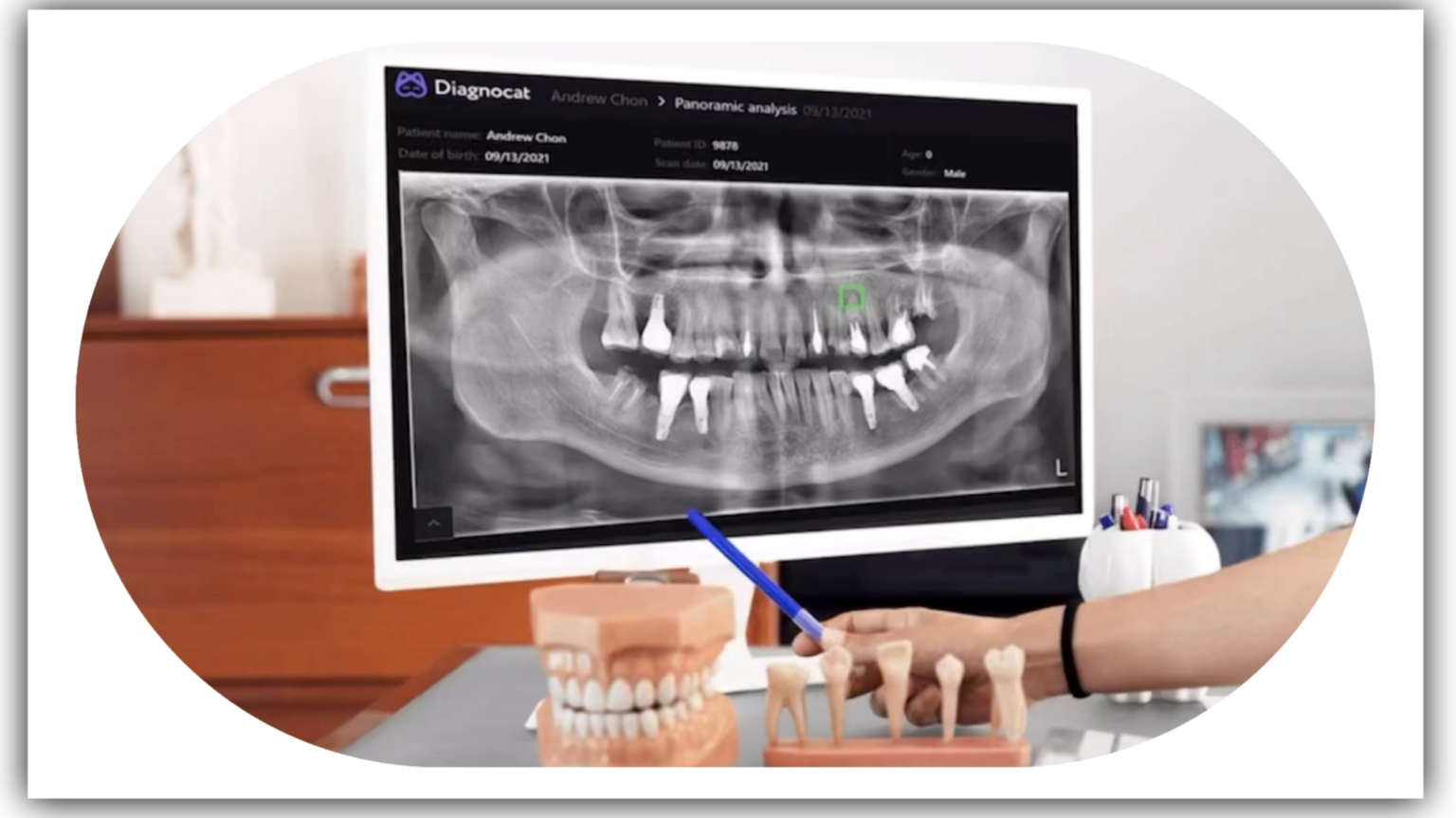Diagnocat’s Artificial Intelligence Cloud Based Software for Dental X ...