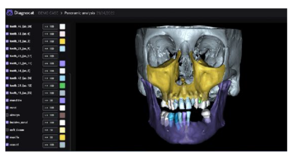 Diagnocat’s Artificial Intelligence Cloud Based Software for Dental X ...