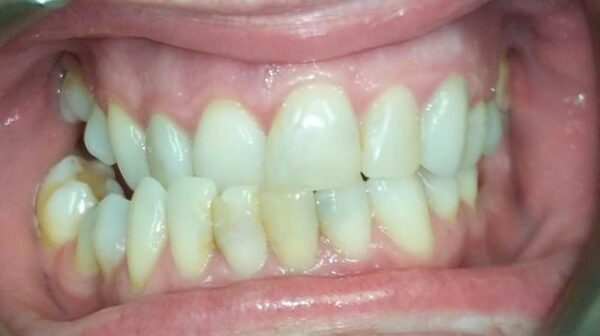 Orthodontics for the Restorative Dentist - Oral Health Group