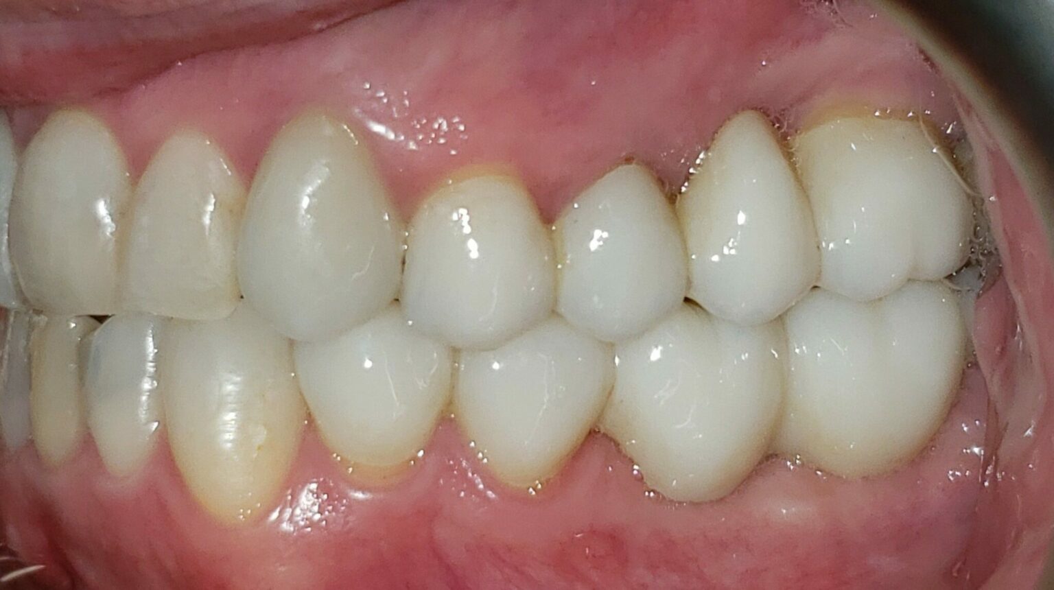 Orthodontics for the Restorative Dentist - Oral Health Group