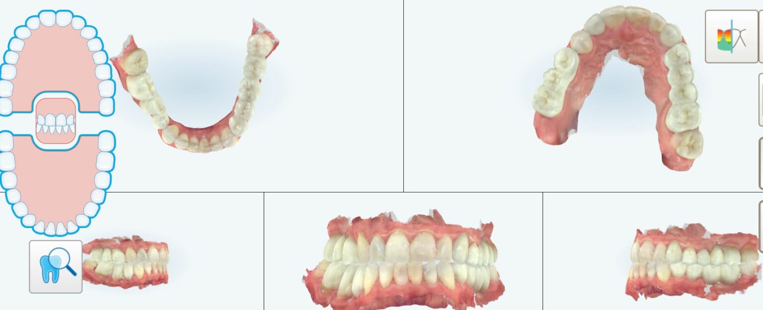 Orthodontics for the Restorative Dentist - Oral Health Group