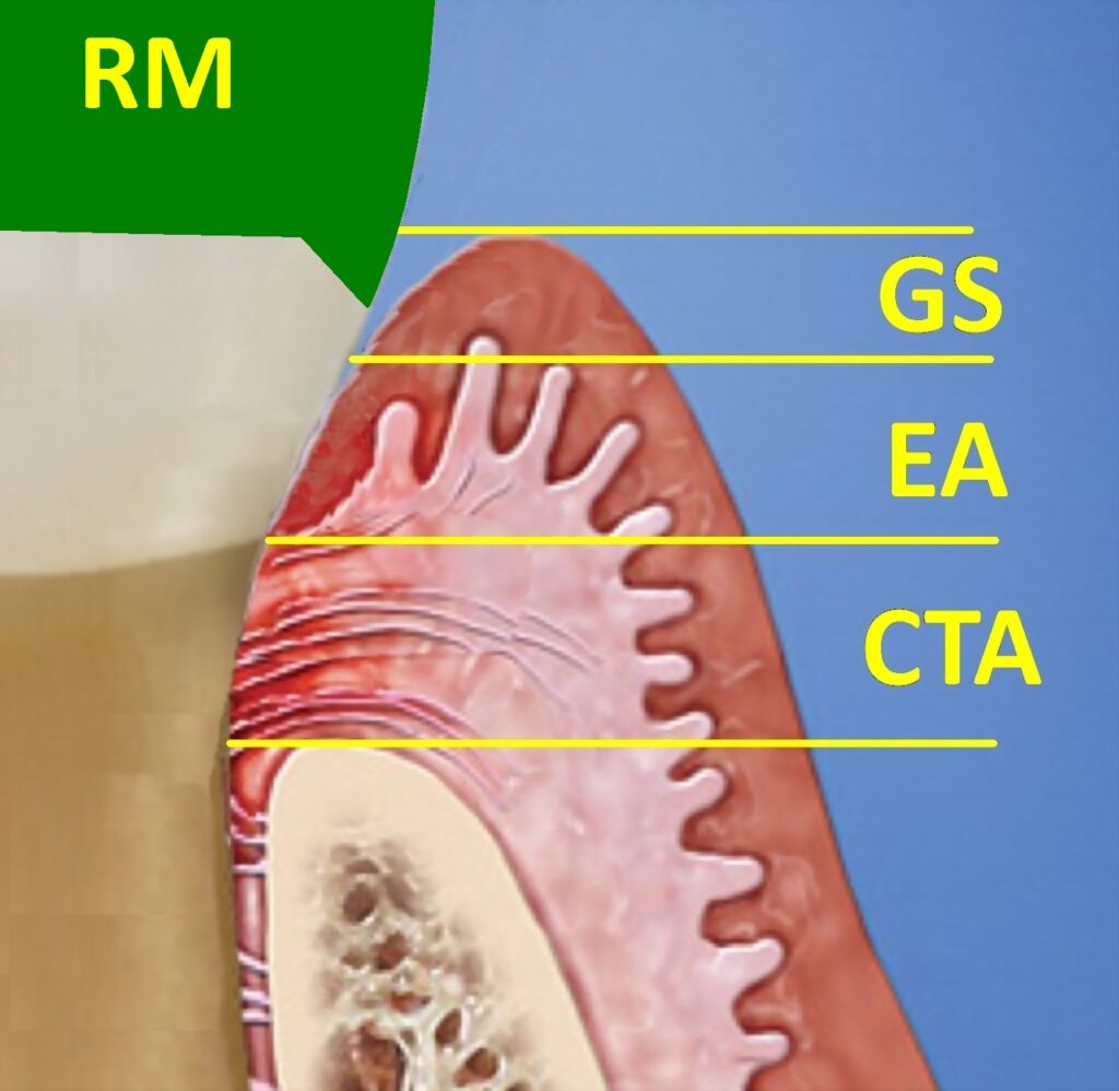 Managing and Maintaining the Periodontal-restorative Interface