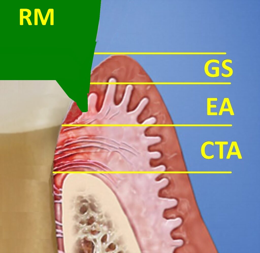 Managing and Maintaining the Periodontal-restorative Interface