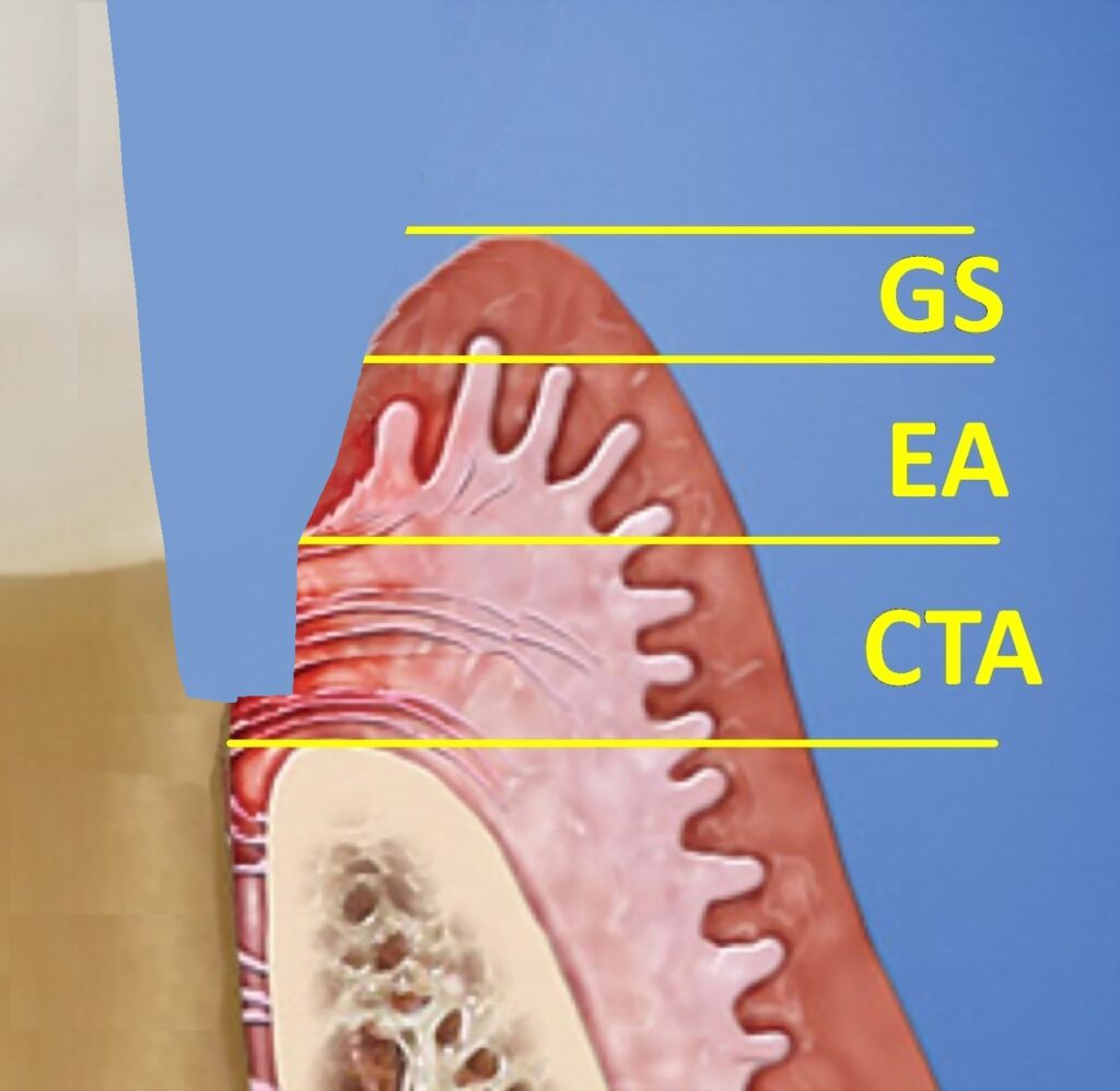 Managing and Maintaining the Periodontal-restorative Interface