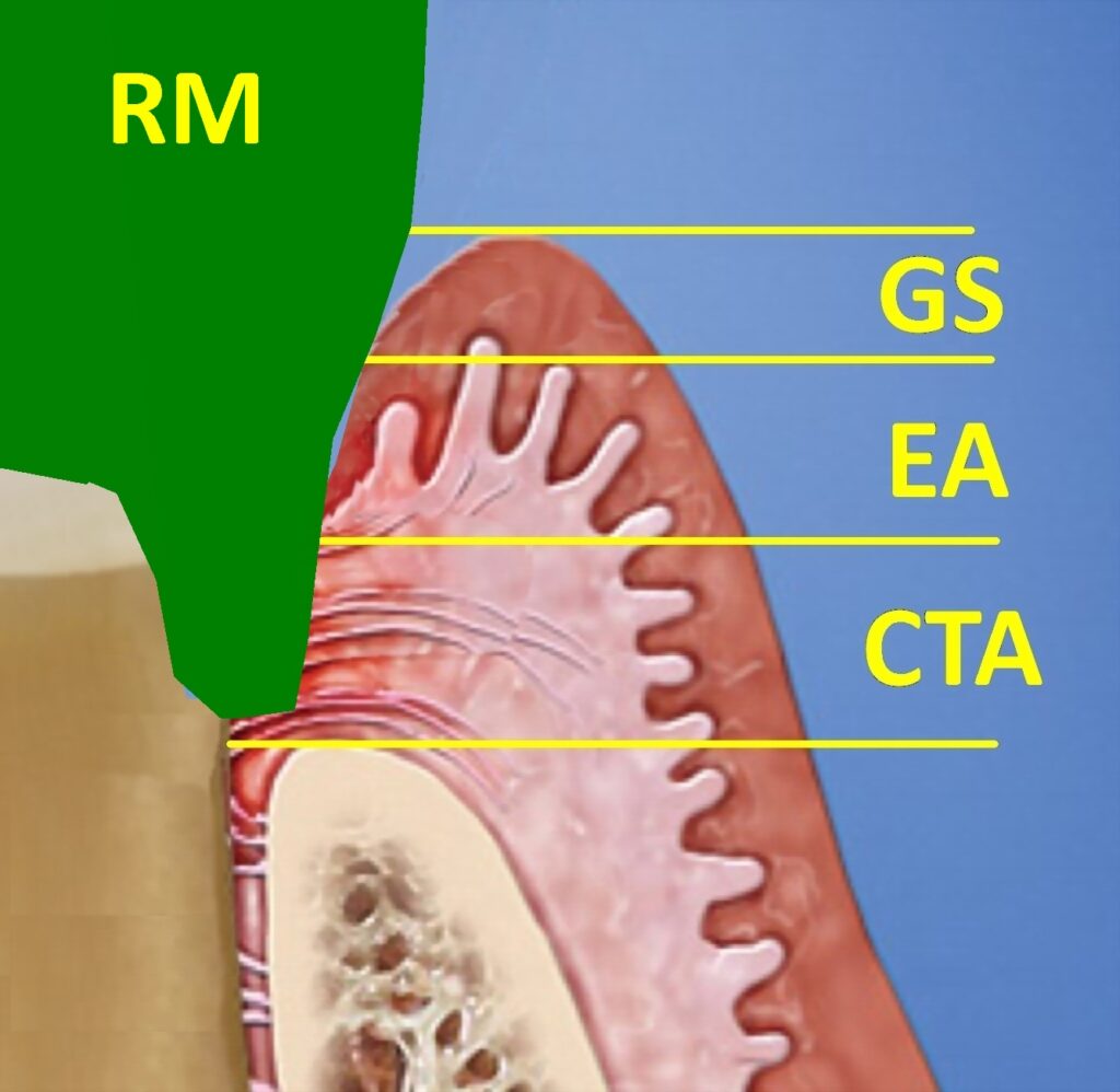 Managing and Maintaining the Periodontal-restorative Interface