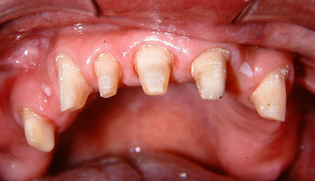 Figure 013 - Oral Health Group