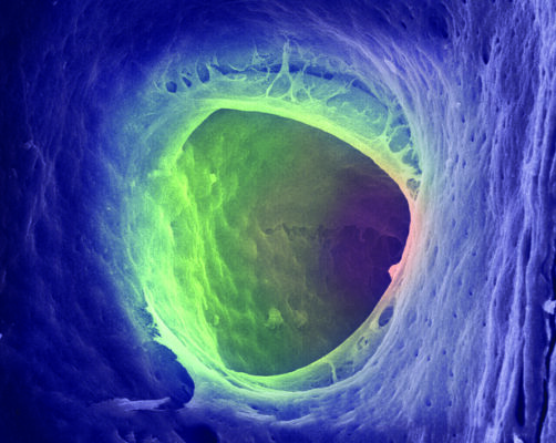 SWEEPS Modality Opens a New Era: Digitally Pulsed Lasers, Endodontics ...