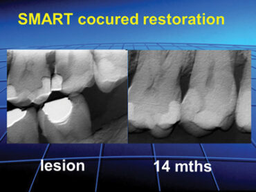 The Mechanical Dentist - Oral Health Group