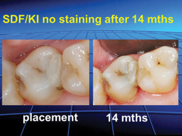 The Mechanical Dentist - Oral Health Group