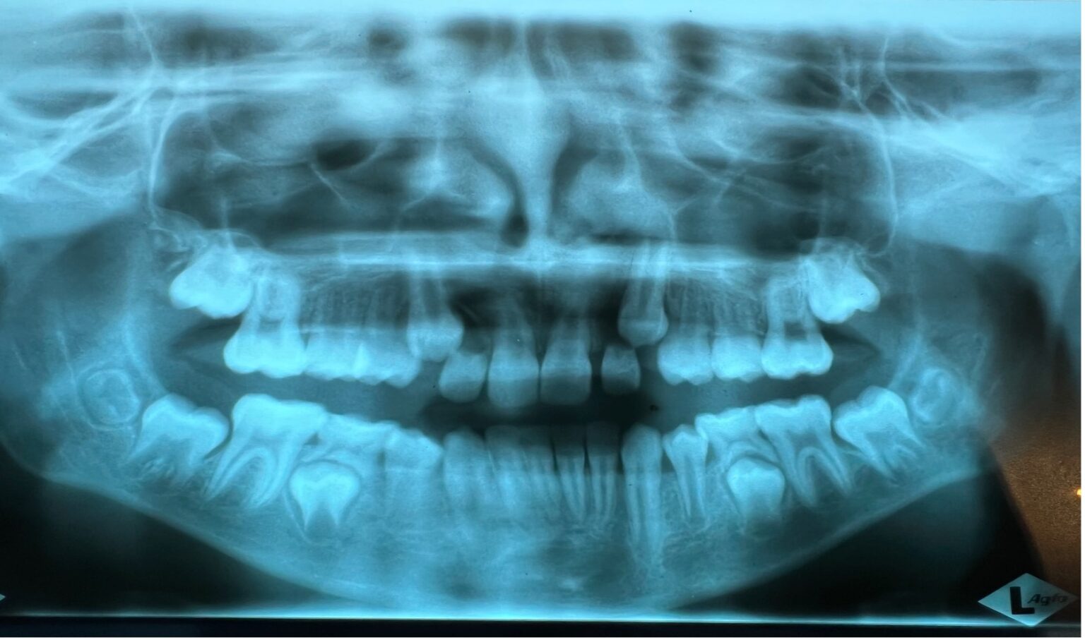 To Expand or Not to Expand? That is the Question