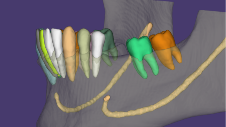 Artificial Intelligence as a Day-to-day Diagnostic Aid in the Dental ...