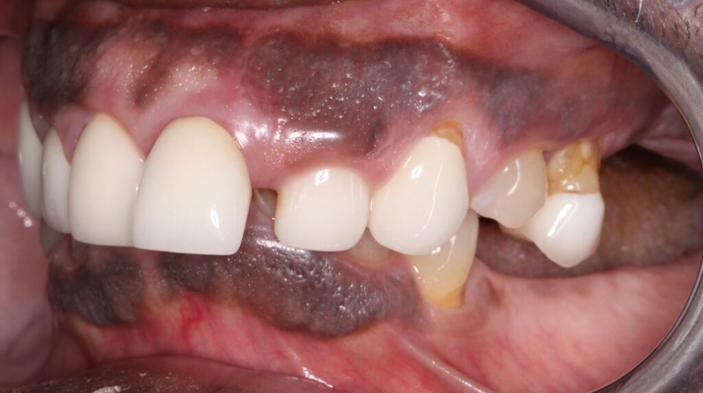 Predictable Aesthetic Success with a Digital Workflow