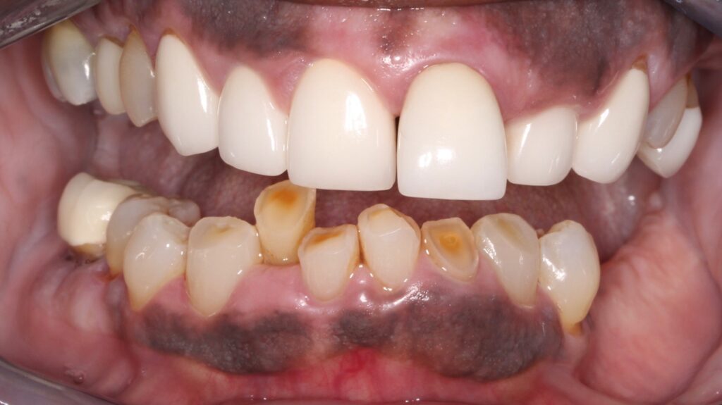 Predictable Aesthetic Success with a Digital Workflow