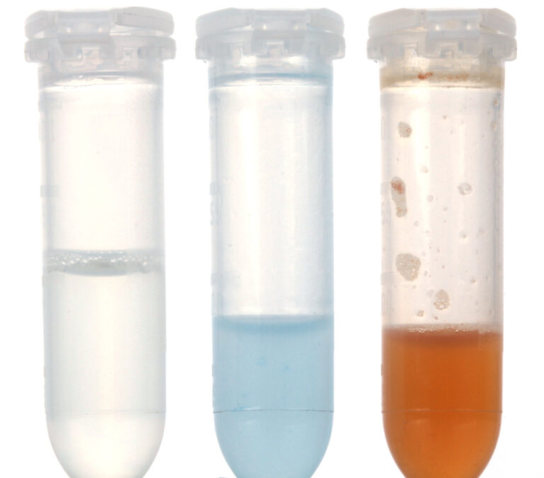 Prevention and Management of Discolored Tooth Preparations