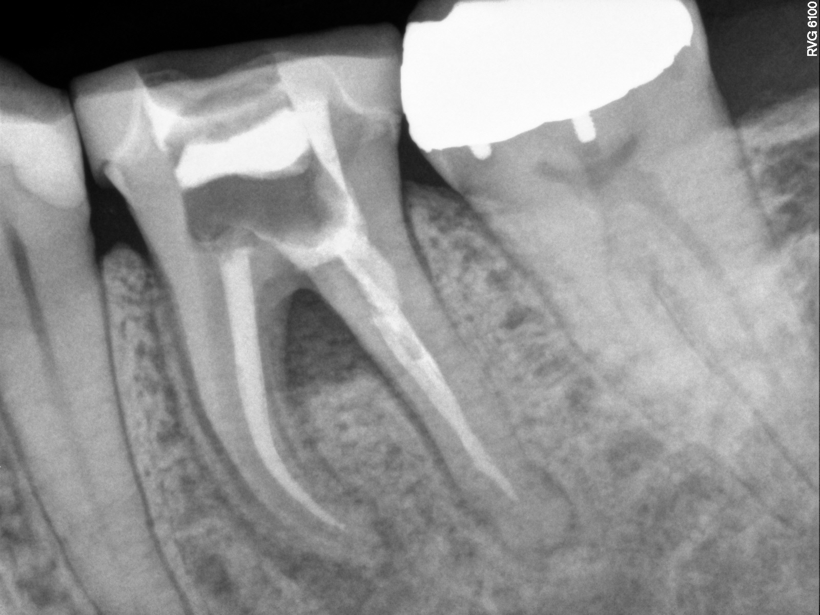 Endodontic Predictability: “What Matters?* - Oral Health Group