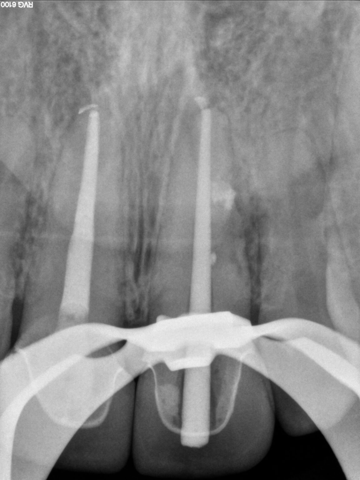 Endodontic Predictability: “What Matters?* - Oral Health Group
