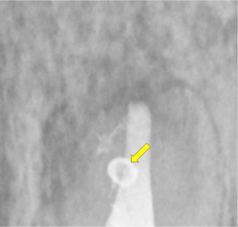 Endodontic Predictability: “What Matters?* - Oral Health Group