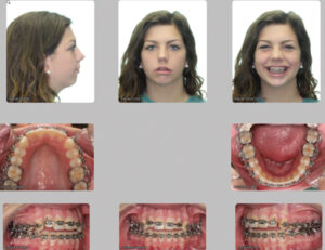 Basics of Corrective Jaw Surgery - Oral Health Group