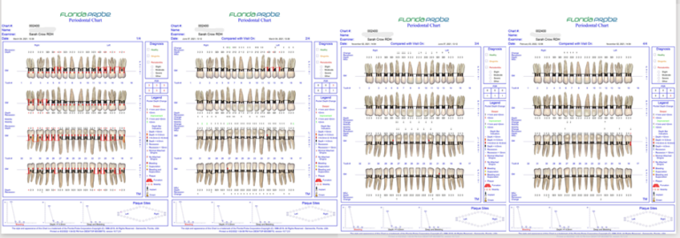 Voice-Activated Periodontal Charting: A Win for Everyone