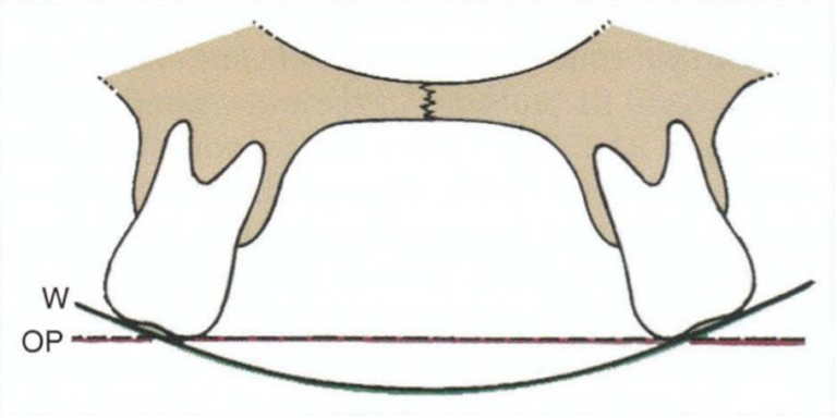 Diagnosis and Management of the Transverse Dimension in Non-Growing ...