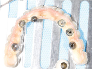 Microsoft Word - Maintenance Appointment of Full Arch Implant Su - Oral ...