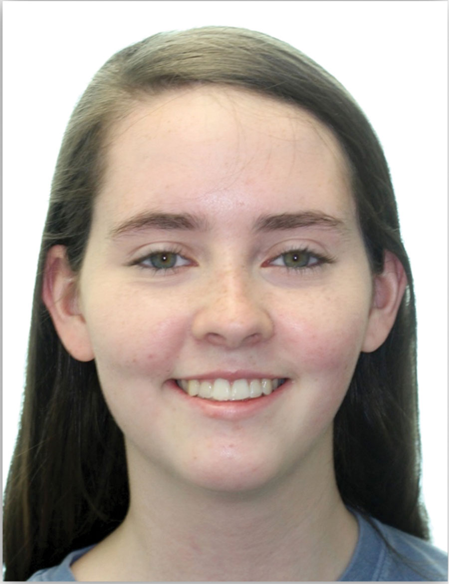 Orthognathic Surgery: Embracing Digital Technology