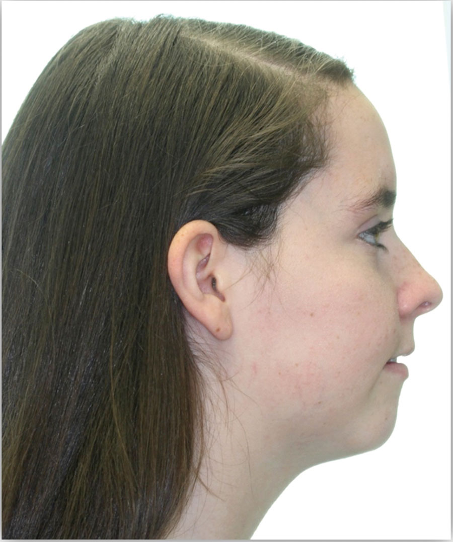 Orthognathic Surgery: Embracing Digital Technology