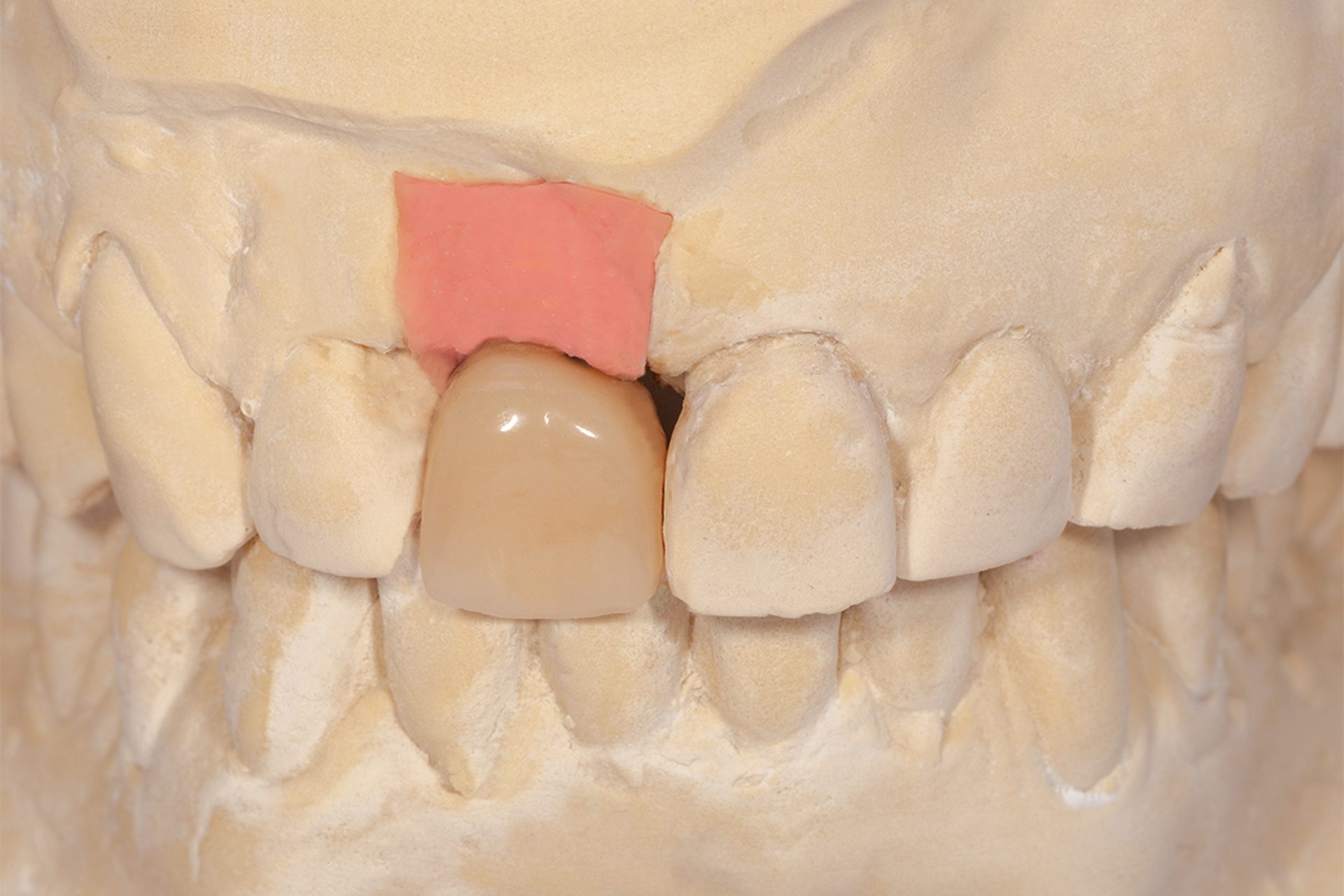 Diagnosis and Management of the Transverse Dimension in Non-Growing ...
